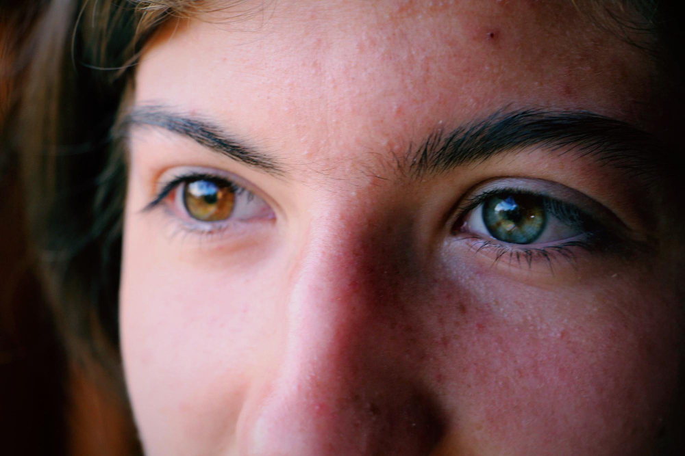 Pigmentation Eyes: Understanding the Causes and Treatments Pigmentation Eyes: Understanding the Causes and Treatments